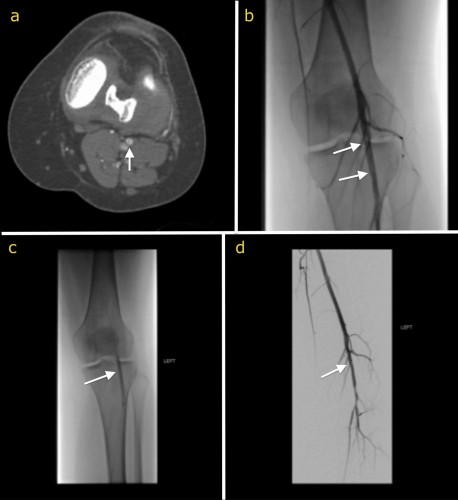 30fpopemb Radiology At St Vincents University Hospital